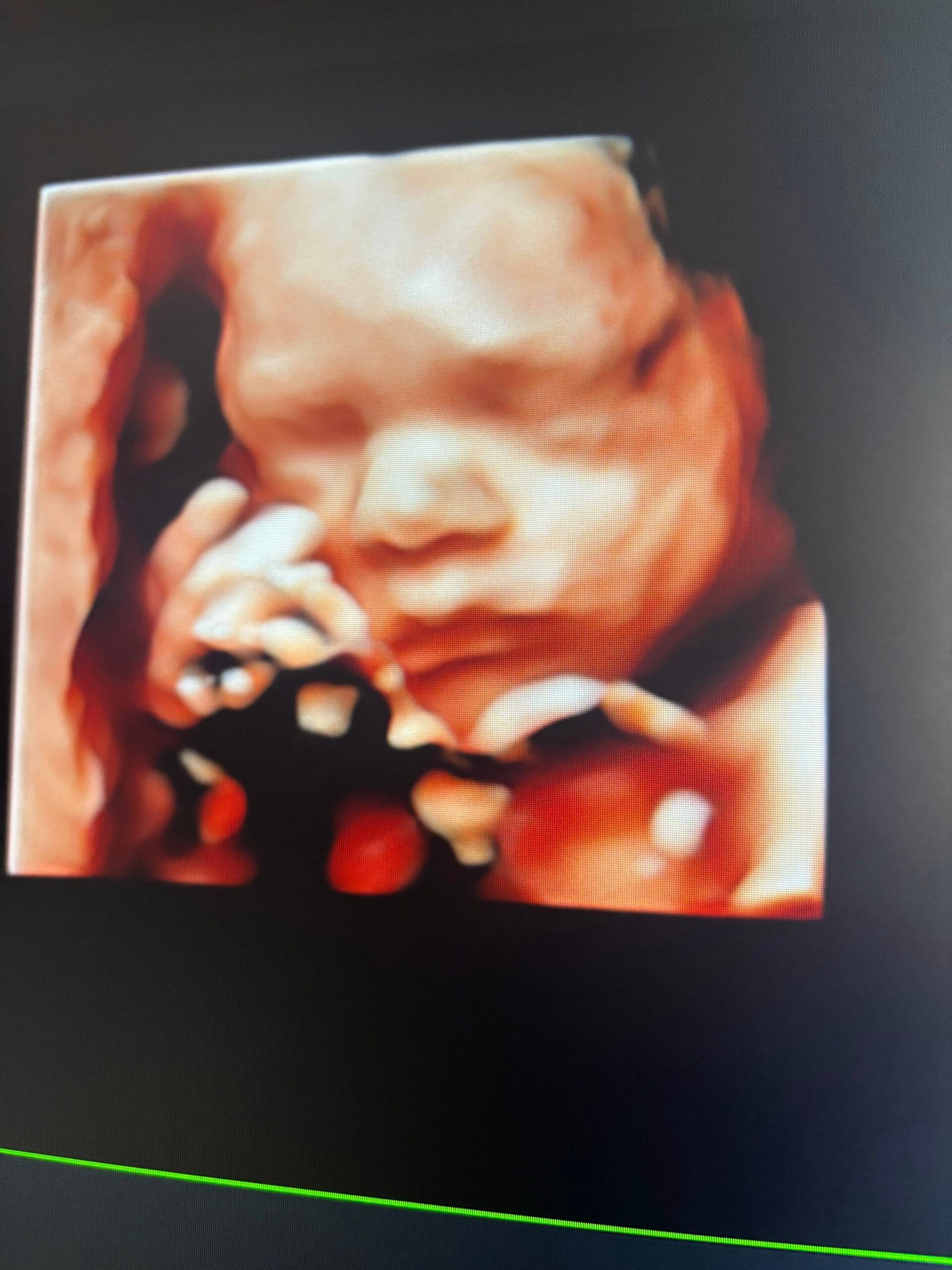 New Sheffield clinic offers earlier baby gender scans for expectant ...